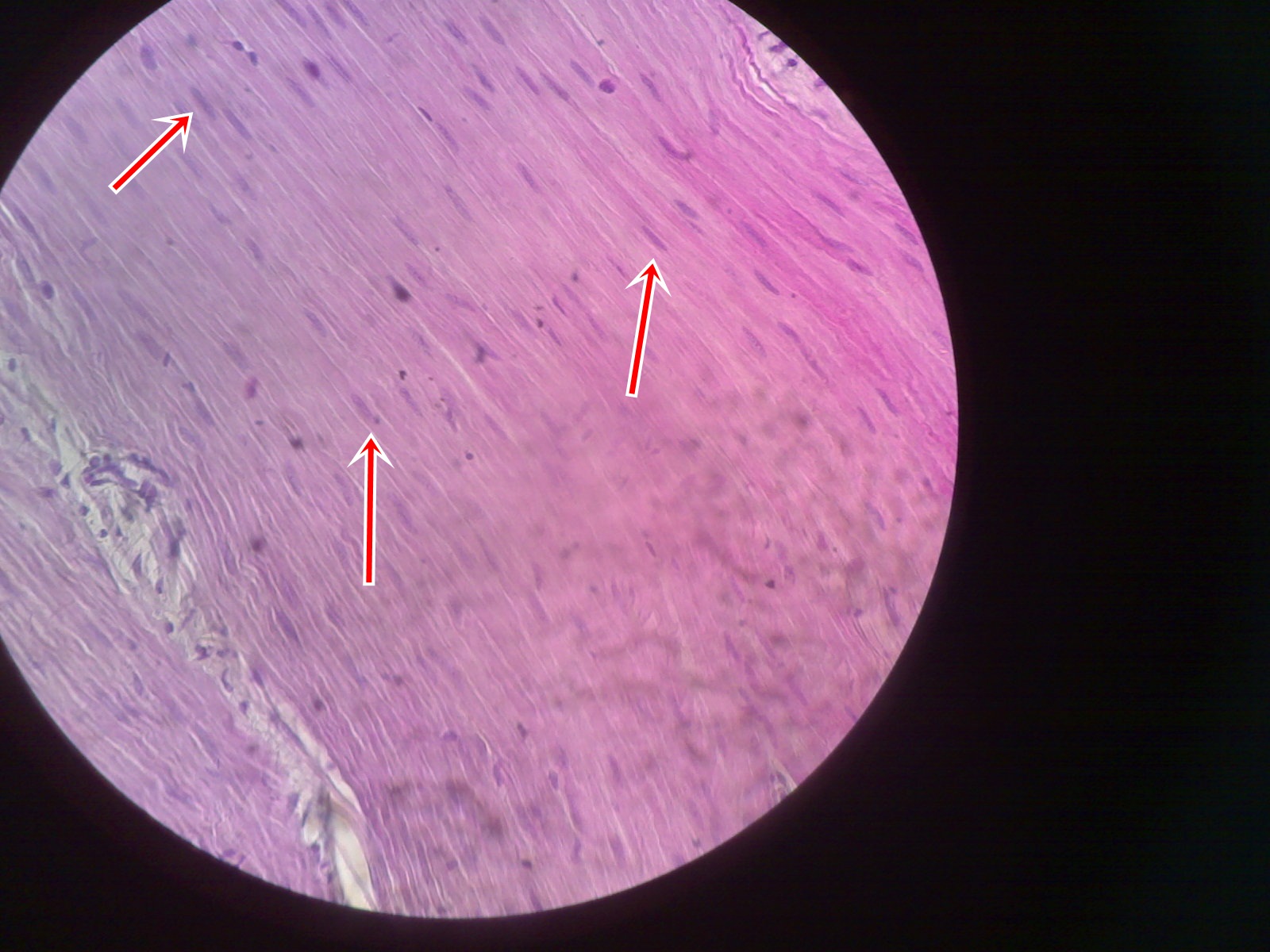 Brain & Soul Energy: Epithelium