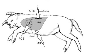 Thoracic Focused Assessment with Sonography for Trauma (TFAST)