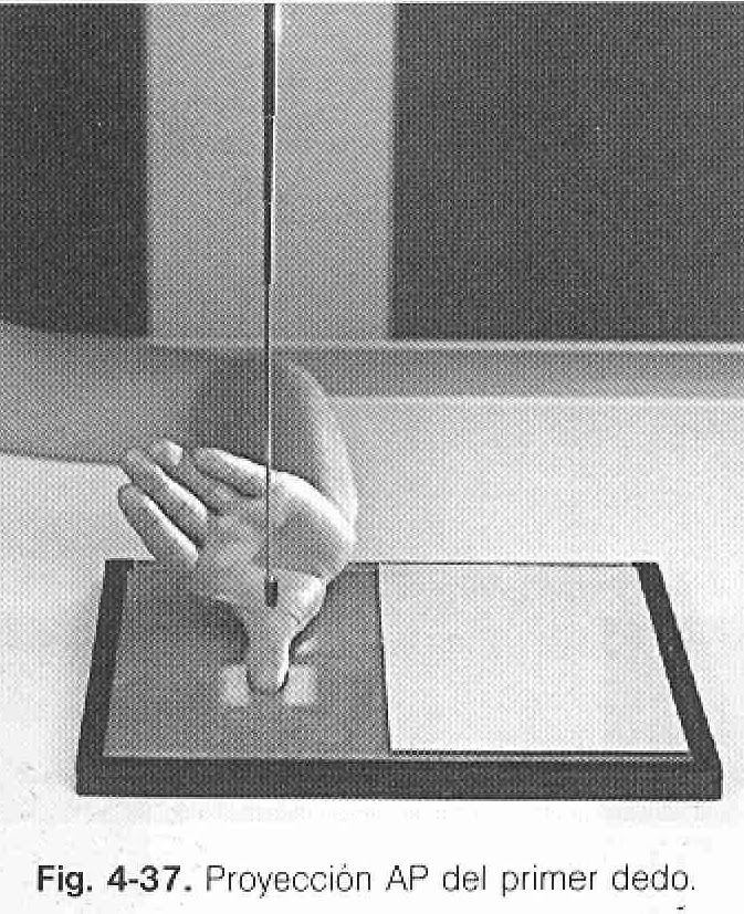 tecradiologos: PRIMER DEDO (PULGAR).