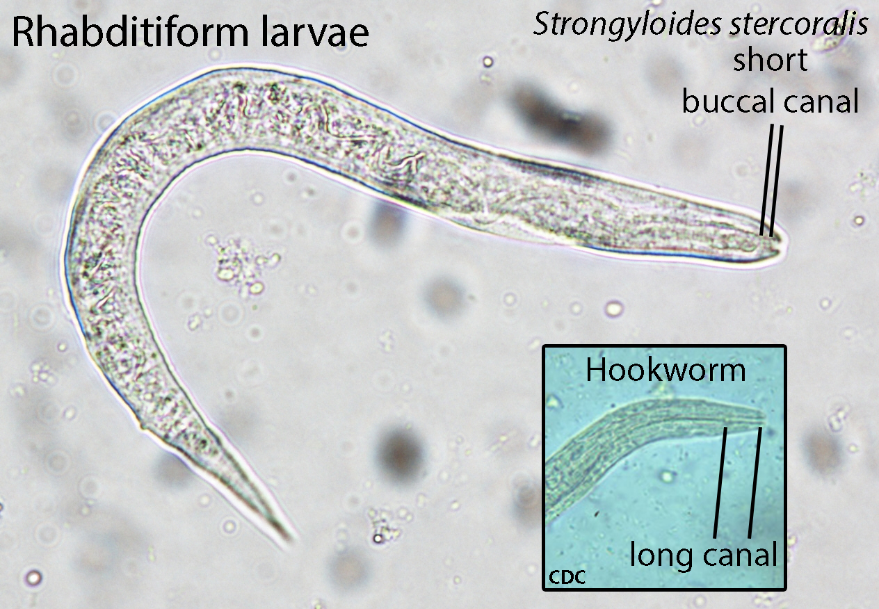 Strongyloides Stercoralis Filariform Larvae