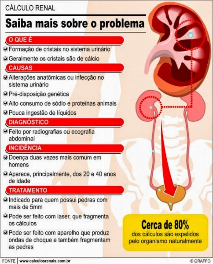 Saiba oque é Cálculo Renal ou Pedra nos Rins . « Bibi Mel Dicas