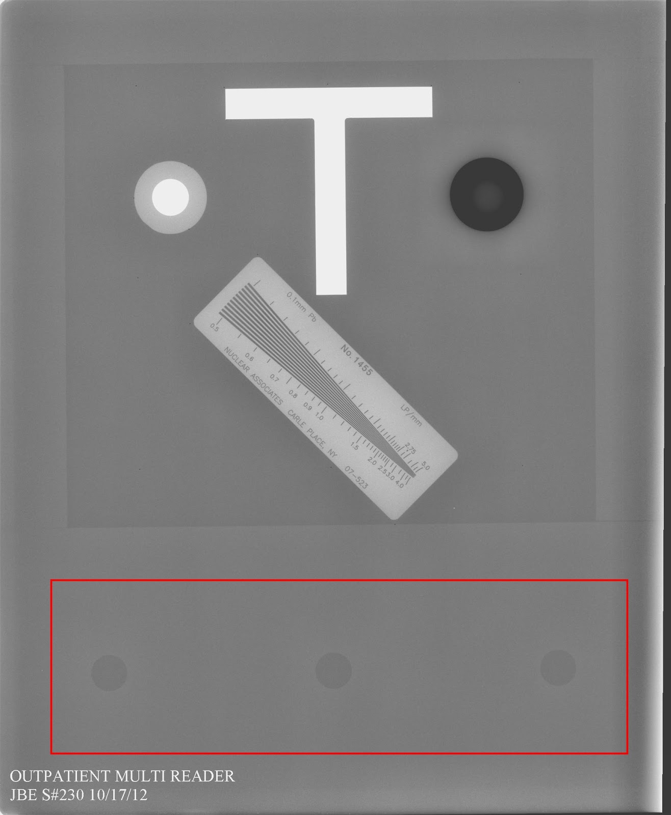 Topics in Radiography: CR Quality Control #6 - Shading Correction