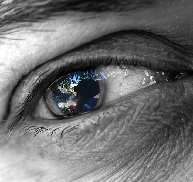 How to perform a Clinical Eye Exam - IVLine