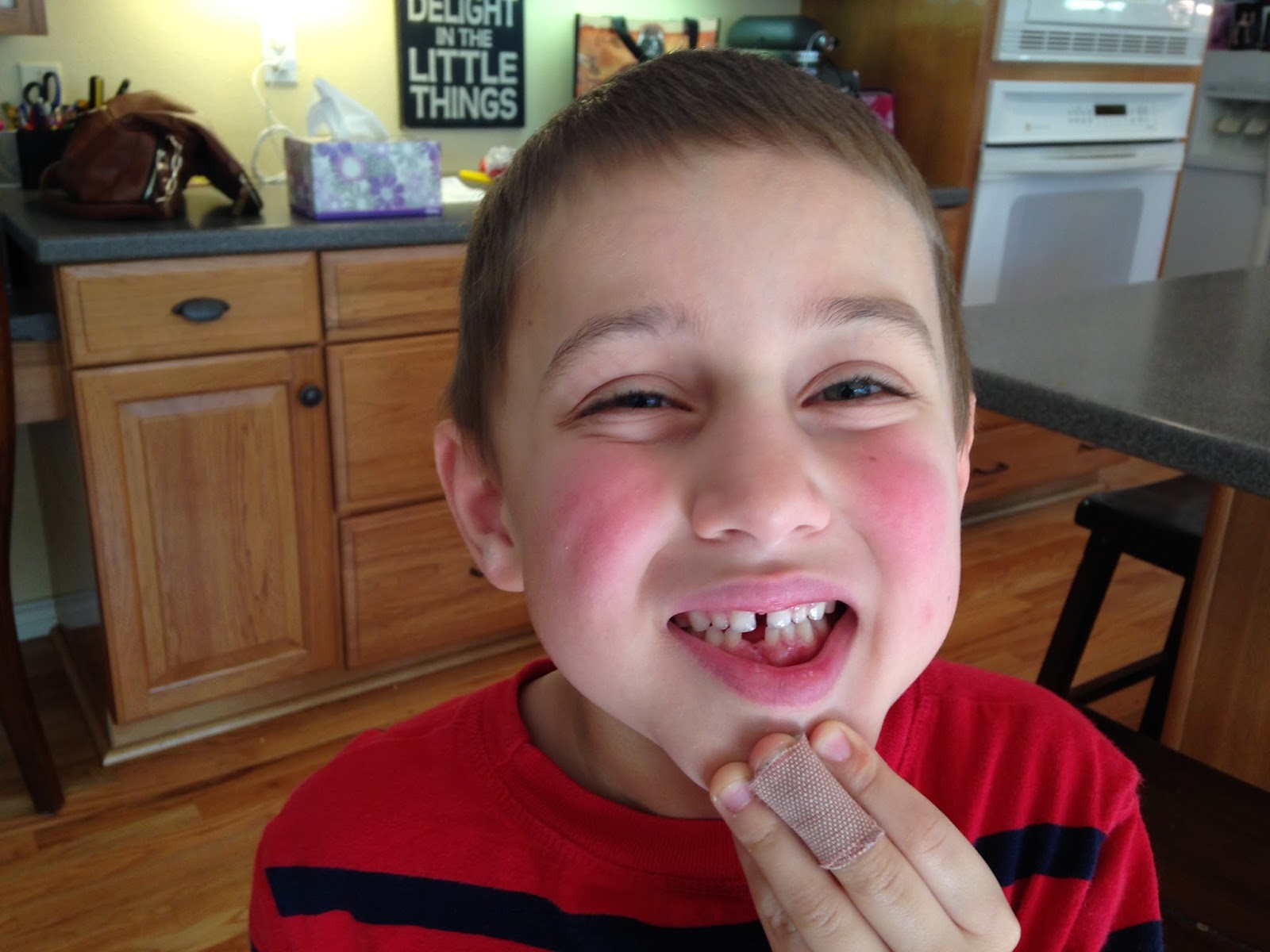 The Oregon Corrigans: First tooth out!