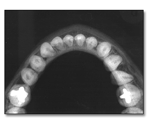 Dentistry and Medicine: Intraoral Radiographic Techniques (Intraoral ...