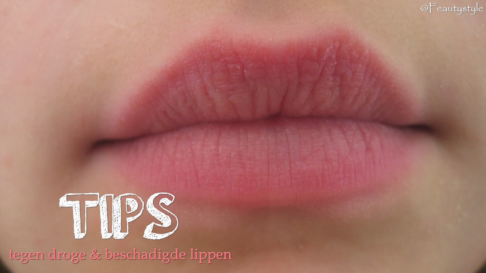 Feautystyle: Tips tegen droge & beschadigde lippen