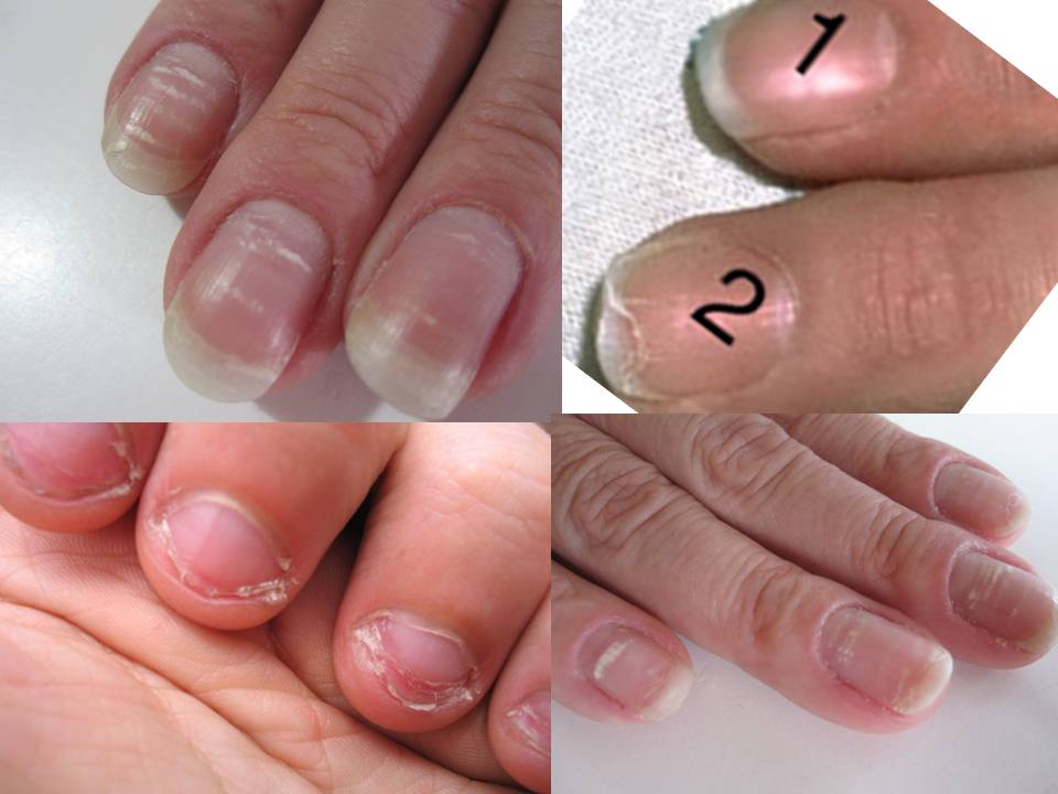 Deda Scarduelli: UNHAS... PODER TOTAL!