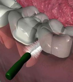 FAMILY CARE DENTAL: April 2012