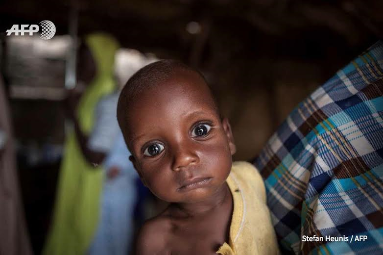 All skin and bones: AFP Correspondent photographs Nigerian starving ...