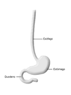 Enfermedades y Tratamiento Preventivo: Patología benigna de esófago