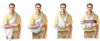 Tipos de vendajes (IV) - Botiquin de primeros auxilios PRO!!