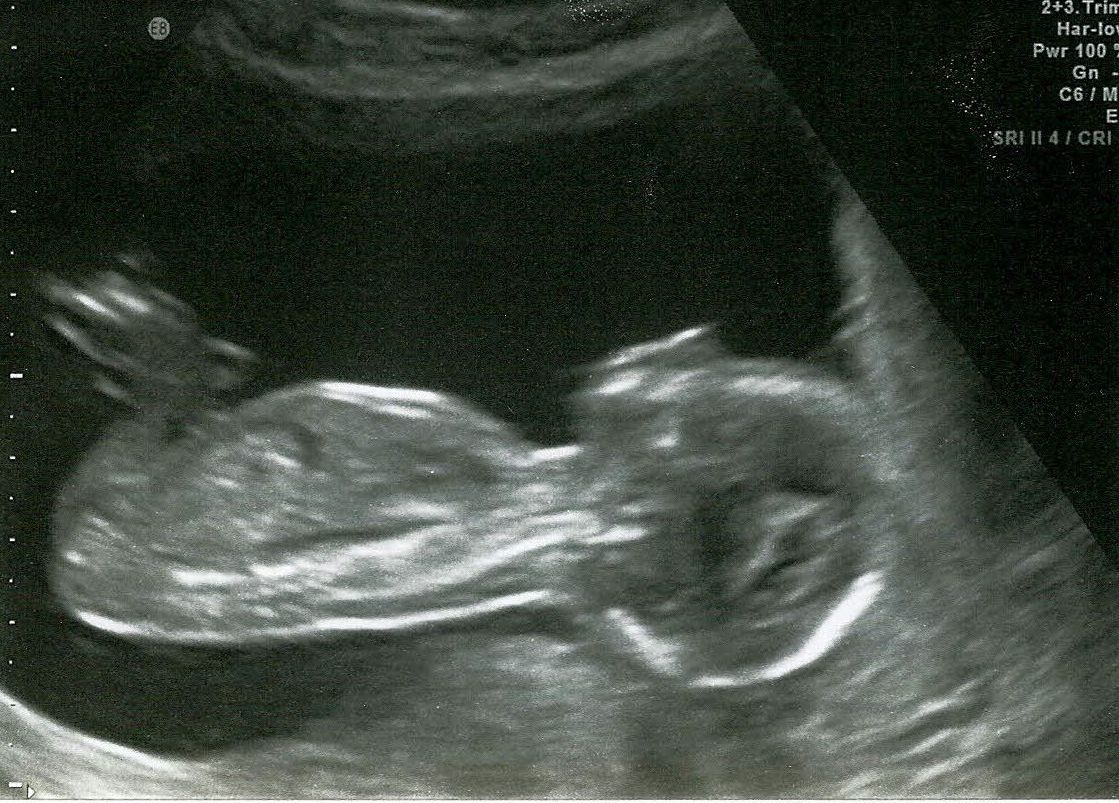 Ultrasound at 17 weeks pregnant - Polyvore