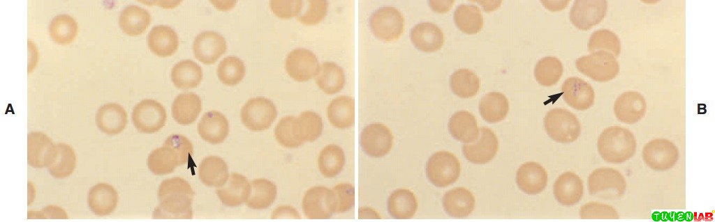[Parasitology] Atlas of Diagnostic Parasitology | Free Medical Atlas