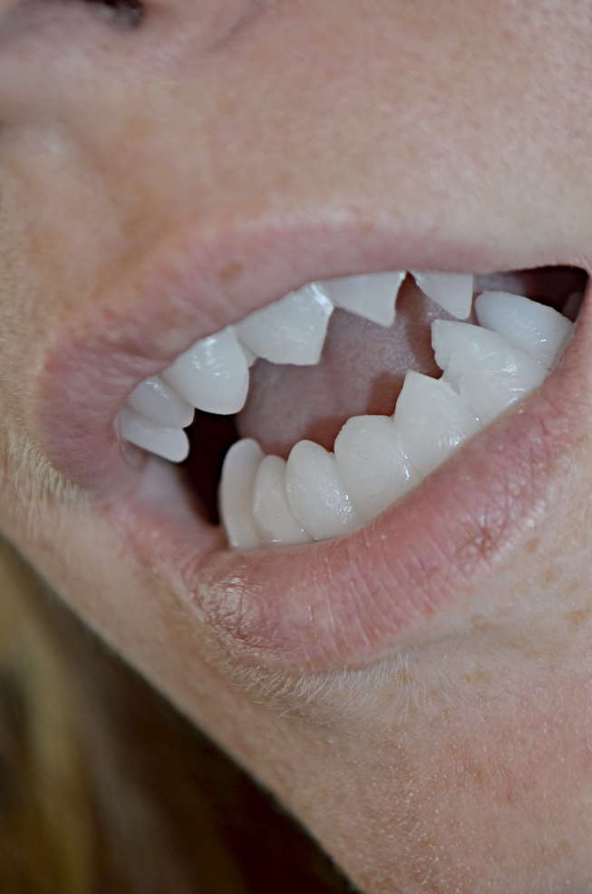 A world of creativity: Polymorph Teeth Walkthrough