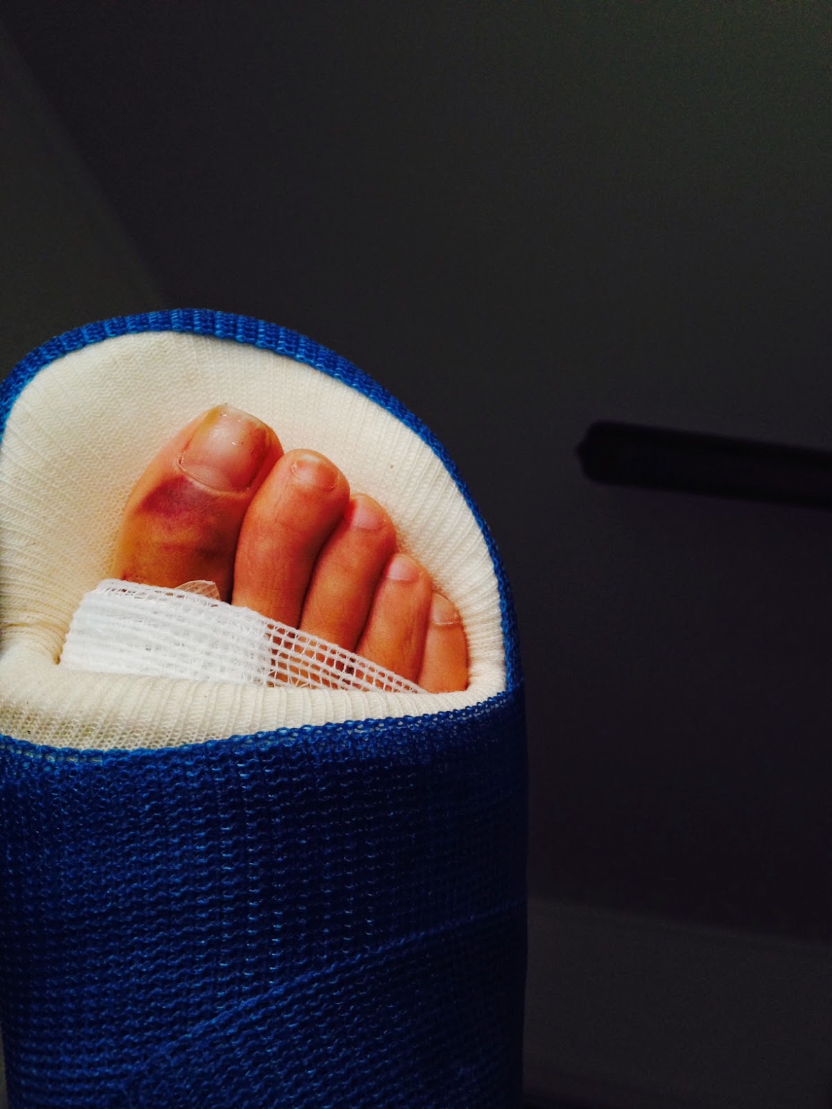 The Bloomin' Bunion: Bunion Surgery & Recovery Blog: April 2015