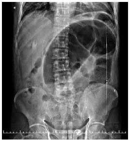 LAGG: SINAL DO GRÃO DE CAFÉ