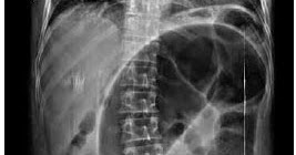 LAGG: SINAL DO GRÃO DE CAFÉ