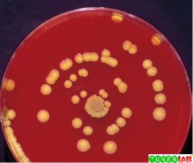 [Microbiology] Atlas of Enterobacteriaceae | Free Medical Atlas