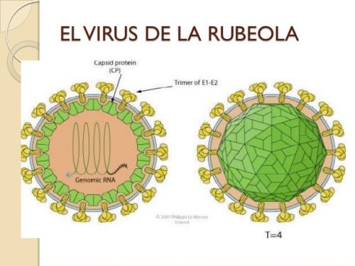 Rubéola Congênita: Rubéola Congênita