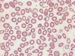 Special Studies Of Red Blood Cell (RBC) - AdmiLab