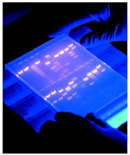 Medicina y bioquímica: Electroforesis del ADN