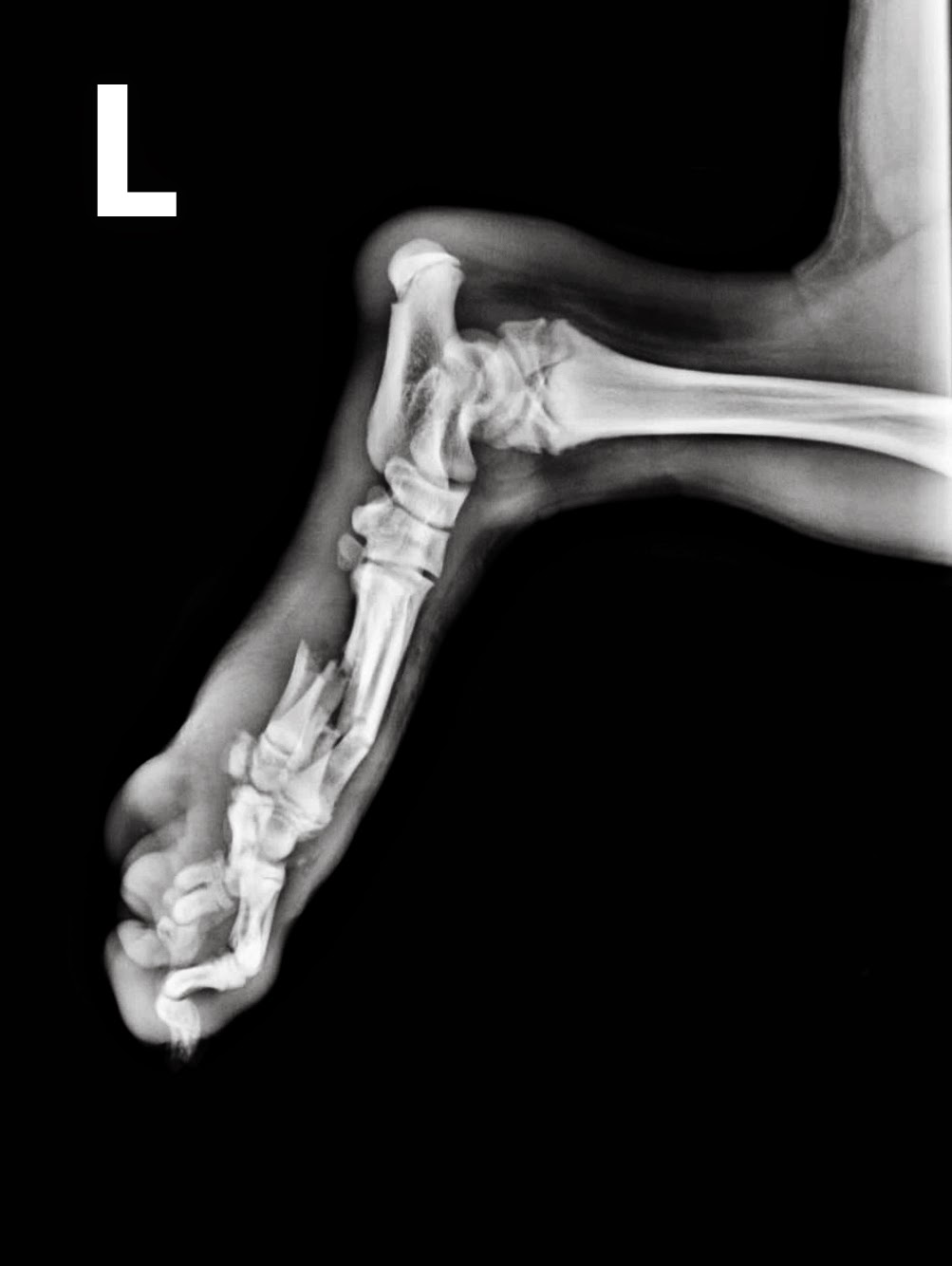 ARTROVET: Fractura de metatarsos