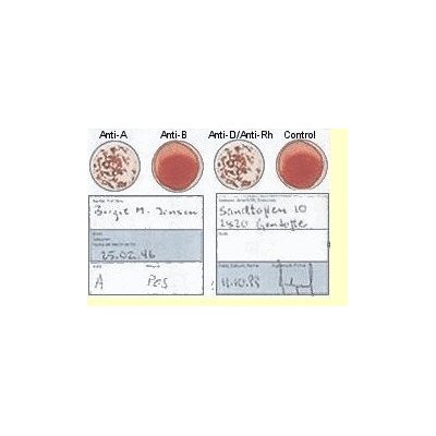 The Thoughts of Angela: Fun with home blood type tests