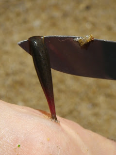 Survival Guide for Expat Aid Workers: How to remove a leech