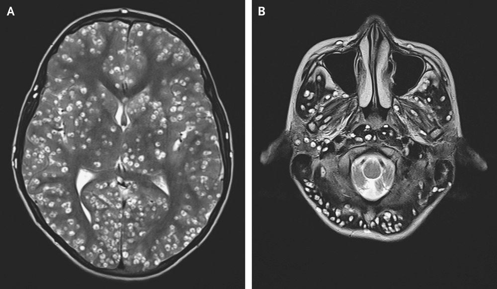 DICAS DE RADIOLOGIA - Tudo Sobre Radiologia: JOVEM MORRE APÓS TER ...