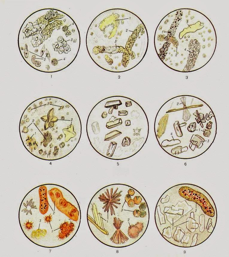 Urine Sediment Slides