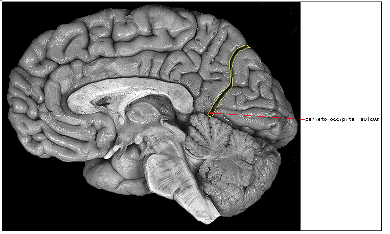 Atlas de neuroanatomía: FISURAS, SURCOS Y GIROS
