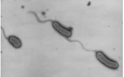 Les bactéries des diarrhées aiguës(7) Vibrio cholerae | Bio Tech Lib