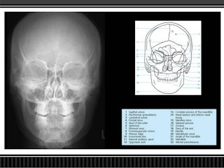 Unidad VI: TÉCNICAS RADIOGRÁFICAS EXTRAORALES