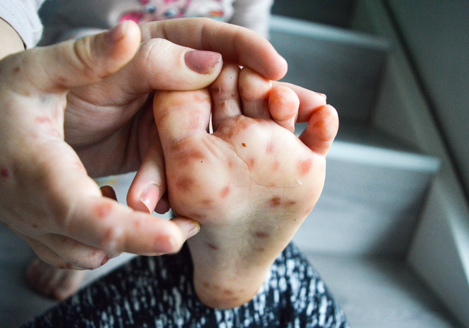 Kädenjälkiä sydämessä: PASKAMAINEN ENTEROROKKO