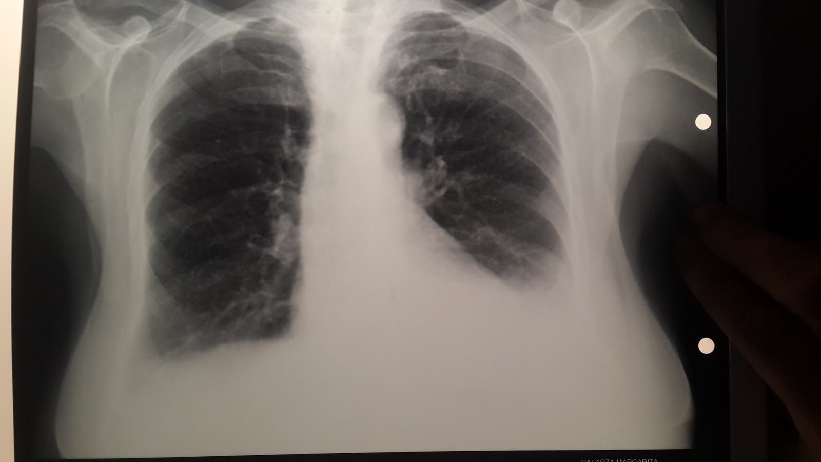 EL RINCÓN DE LA MEDICINA INTERNA. juanpedromacaluso@yahoo.com.ar: 11 ...