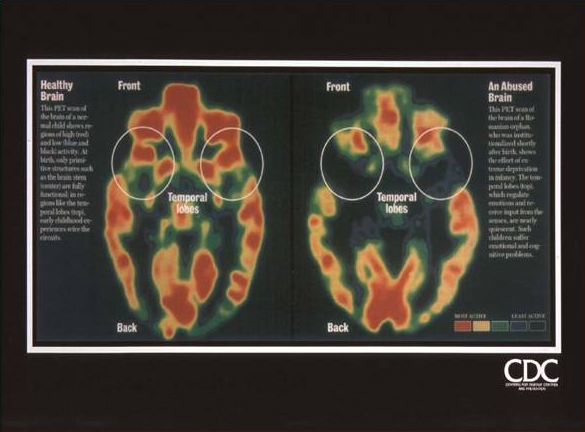 In the Face of Trauma