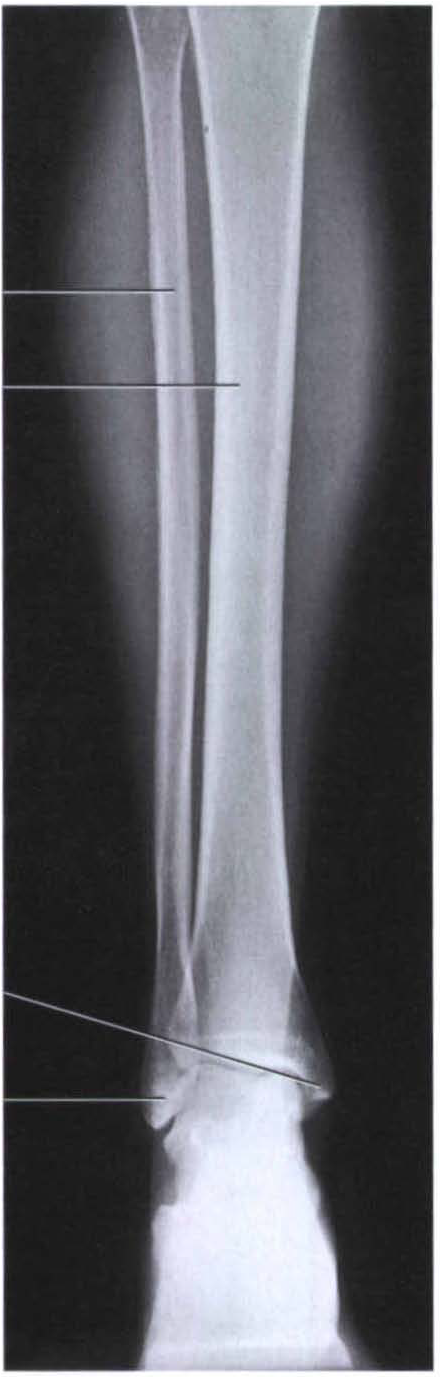 teknik radiografi: 2017