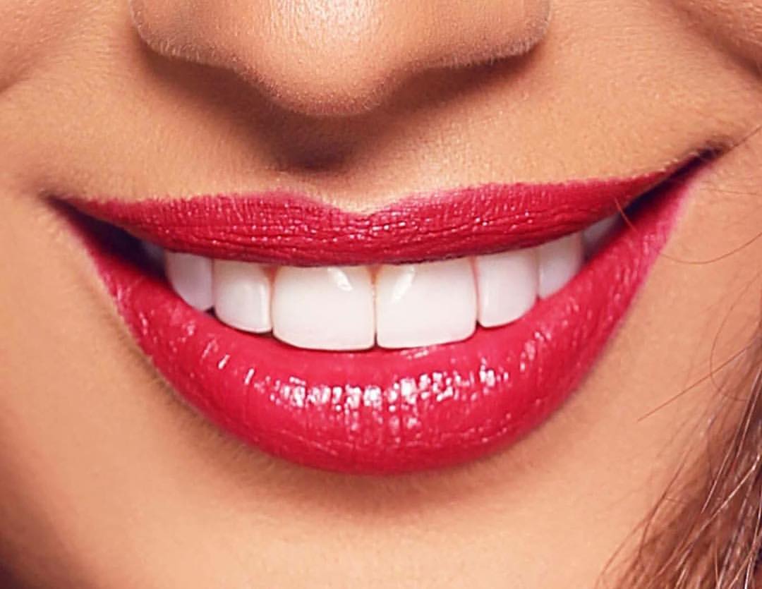 Hollywood smile Beirut Lebanon: Hollywood Smile Cosmetic Dentistry ...