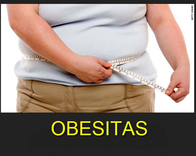 Pengertian Obesitas | Data Rental