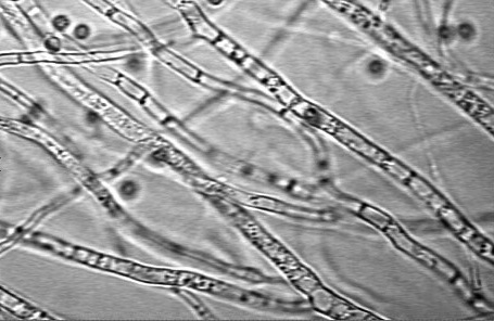 CUADERNO DE CAMPO del Treparriscos: Micobiontes: Los "Hongos Liquenizados".
