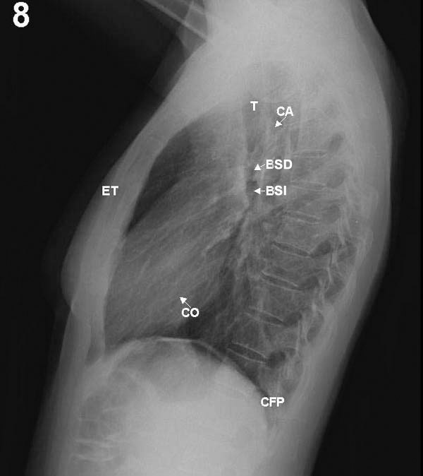 MEDICINA: INTERPRETACIÓN DE LAS RADIOGRAFÍAS DE TÓRAX EN URGENCIAS