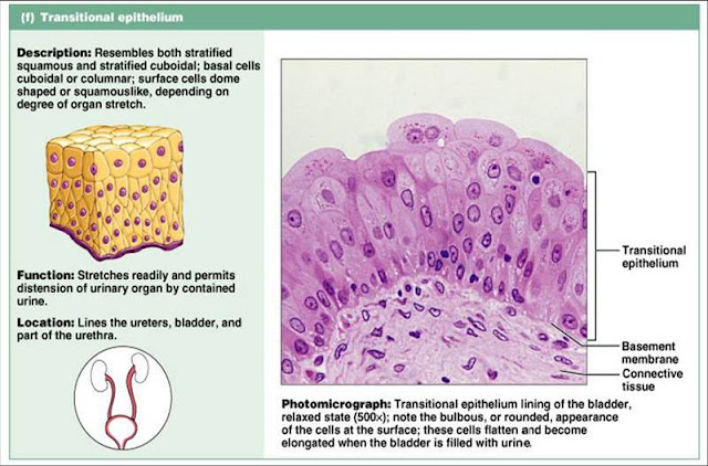 Medical Information and Presentation PPT: Epithelial Metaplasia of the ...