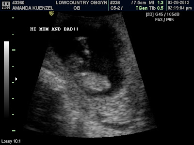 Amy's World: 11 week ultrasound