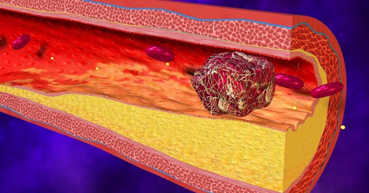 Inspirasi Top Tahap Pembekuan Darah