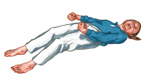 HEALTHY-NURSES: CONVULSIONES EN ADULTOS