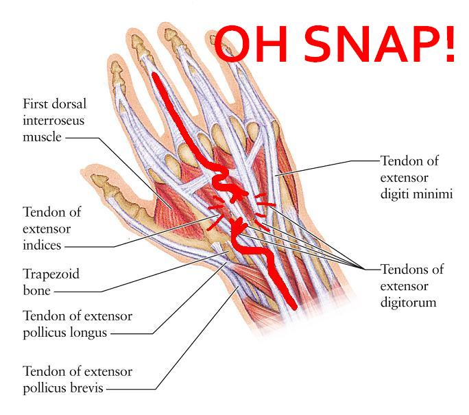 Never impressed.: Oh snap...was the sound your tendon made when it ...