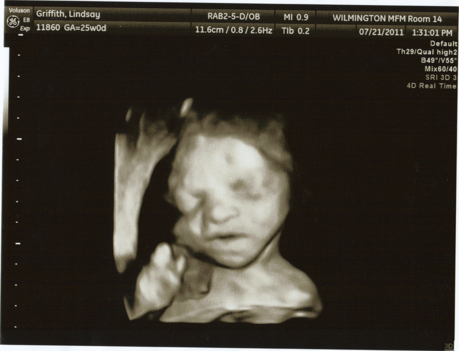 Growing Baby G!: 3D ULTRASOUND!!! Baby G at 25 weeks!