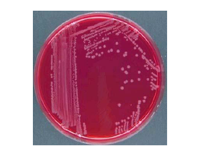 Mikrobiologi : Uji Salmonella: Uji Salmonella