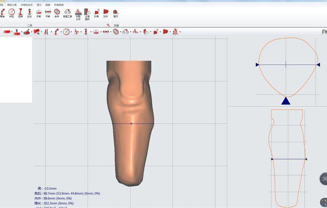 Jay's HealthCare: Comfortable Prosthetic Socket