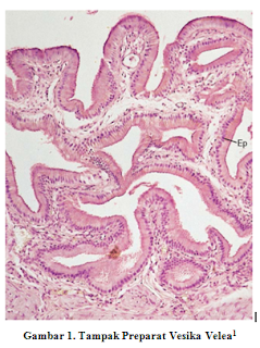 VESIKA FELLEA (KANTUNG EMPEDU) - Mediaku